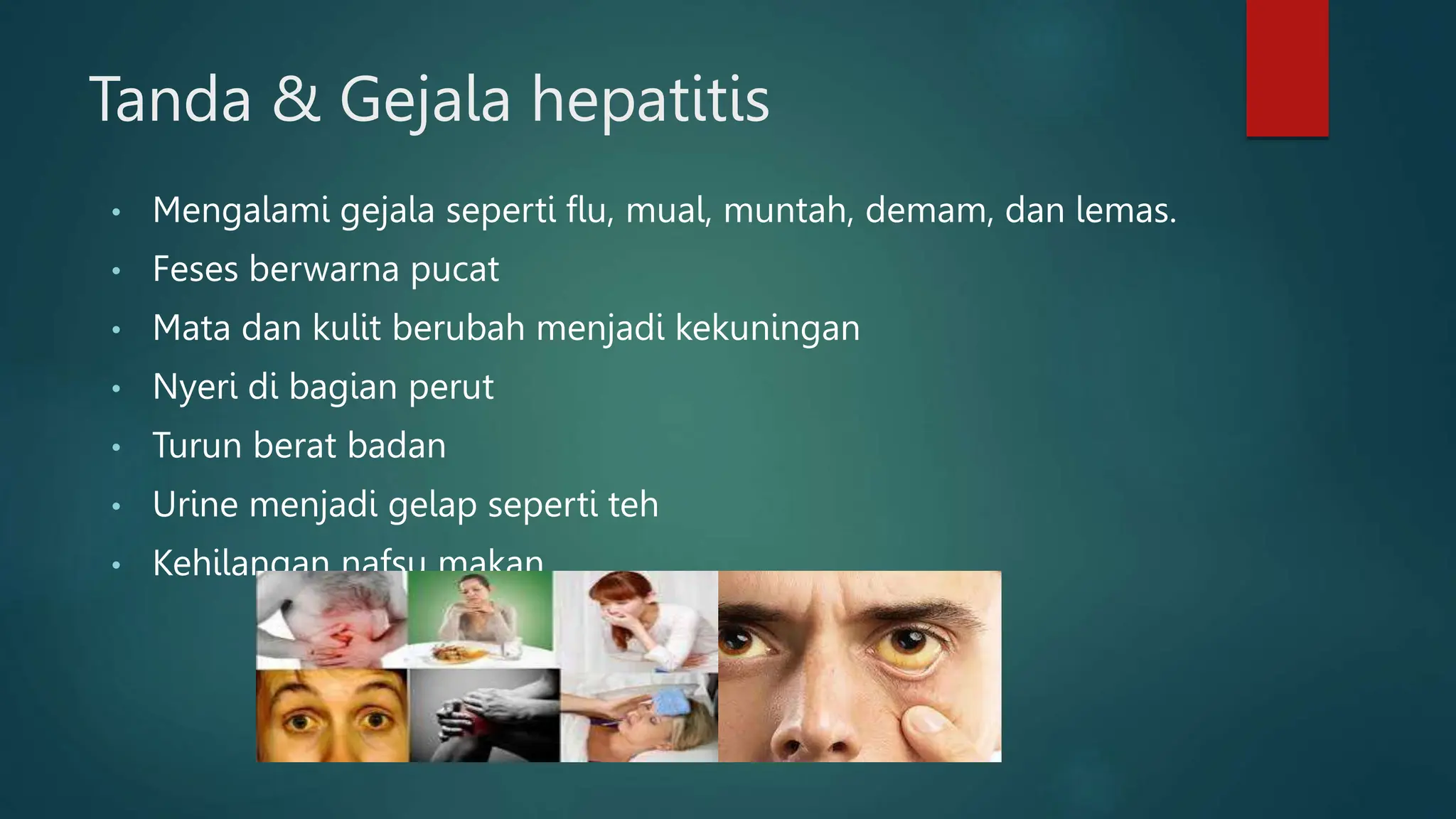 ppt hepatisis (definisi, etiologi, epidemiologi) | PPTX