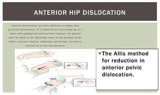 Ppt hip dislocation | PPT