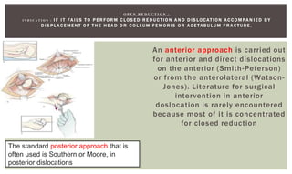 Ppt hip dislocation | PPTX