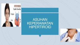 PPT HIPERTIROID.pptx