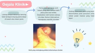 all about hipospadia, criteria and diagnosis | PPTX