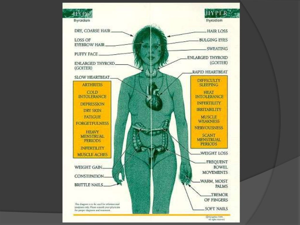 Ppt hipotiroid dan hipertiroid