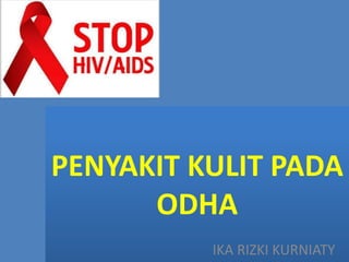 Materi mengenai Penyakit kULIT HIV DAN AIDS | PPTX