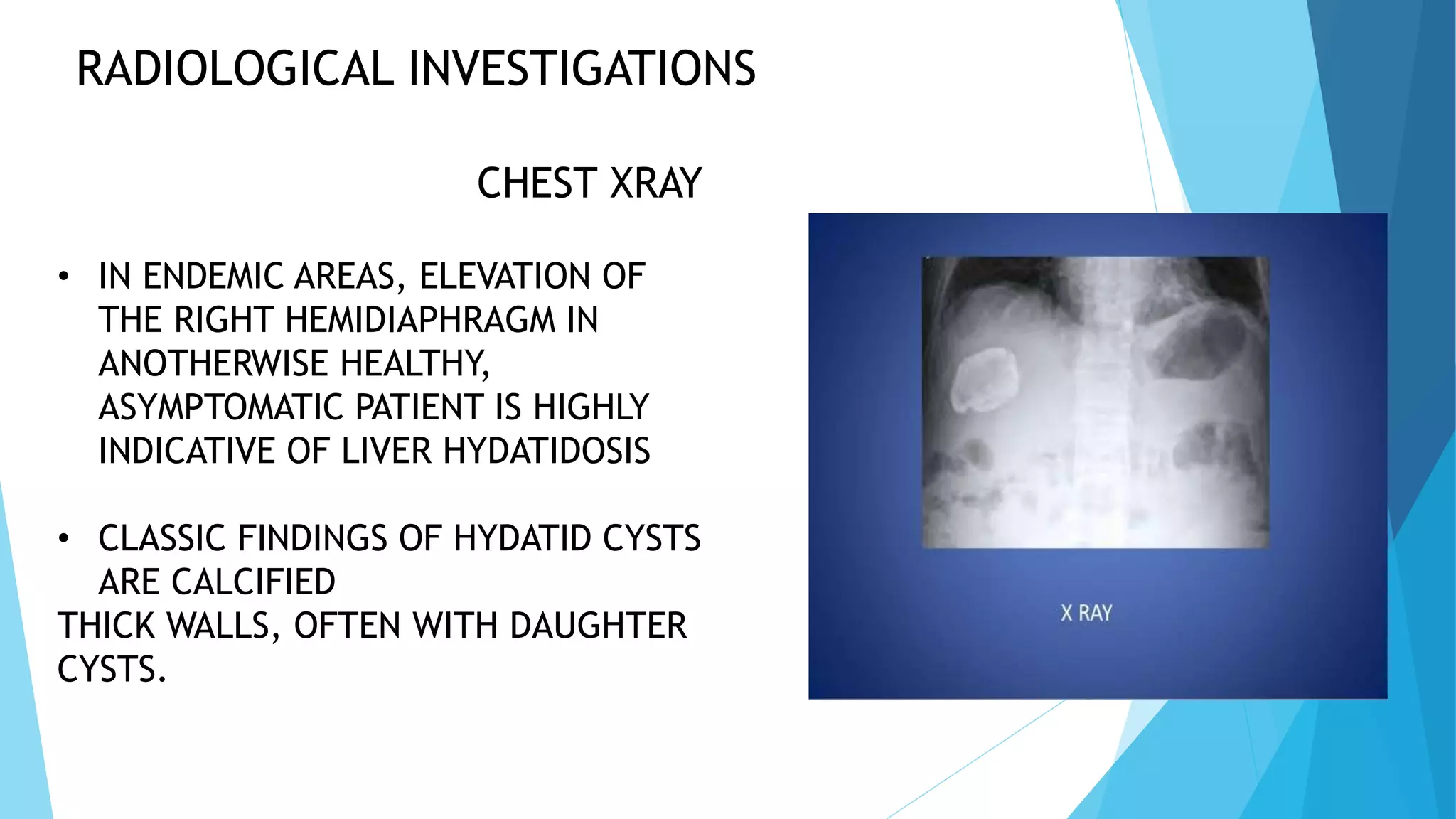 HYDATID cyst.pptx
