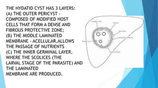 HYDATID cyst.pptx