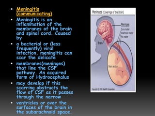hydrocephalus | PPTX