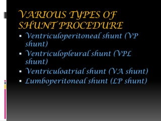 hydrocephalus | PPTX