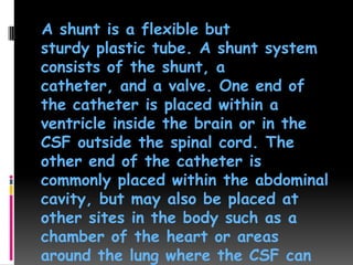 hydrocephalus | PPTX