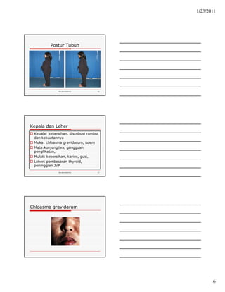 Ppt ibu hamilllllllllllllllllllllllll | PDF