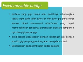 ilmu gigi tiruan fixed bridge / gigi tiruan jembatan | PPTX