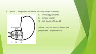 Ppt ihps bedah anak | PPTX