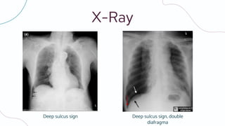 PPT Ilmiah Radiology | PPTX