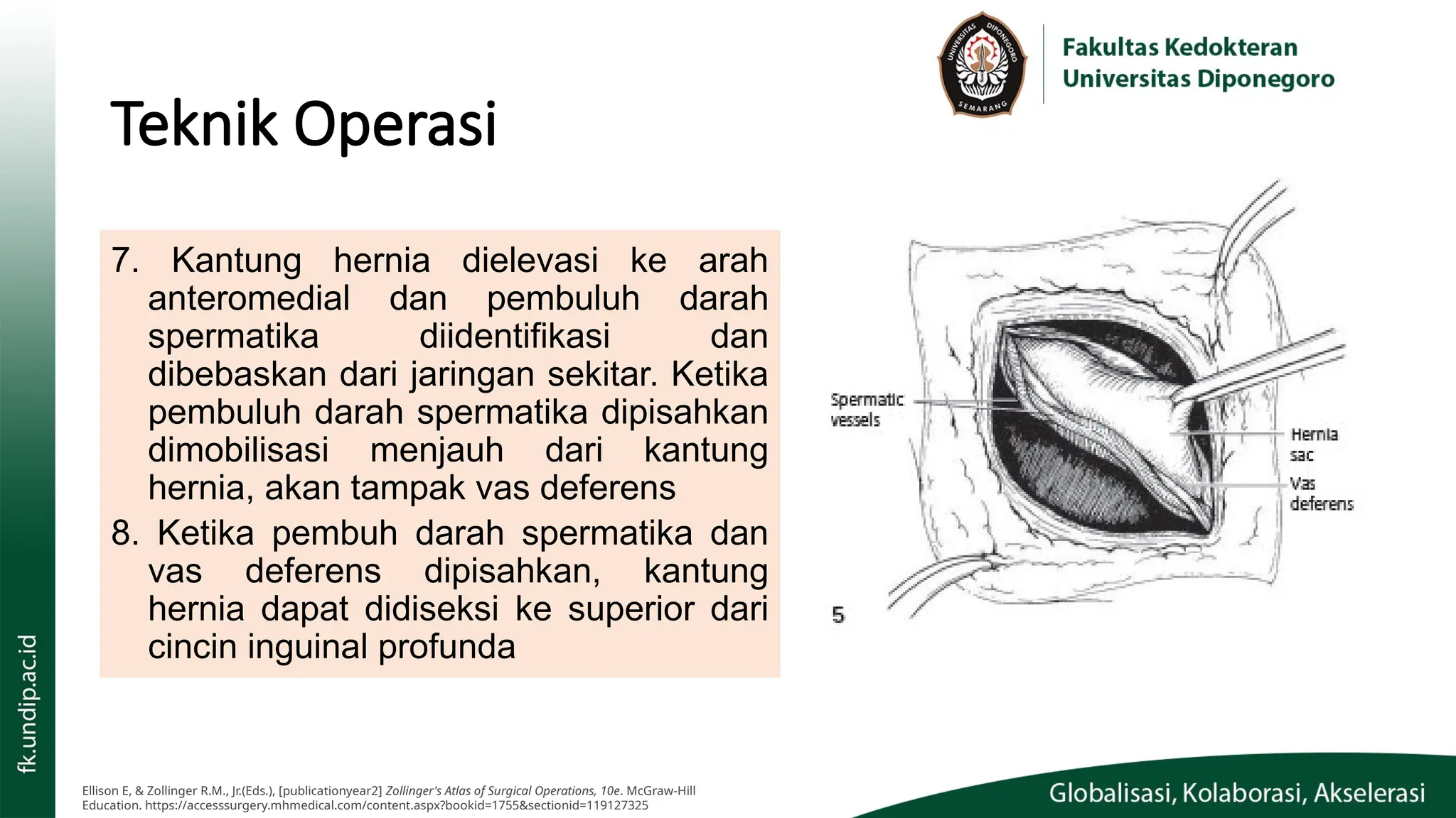 PPT Ilmiah Jumat Hernia inguinalis dan Hidrokel pada anak.pptx