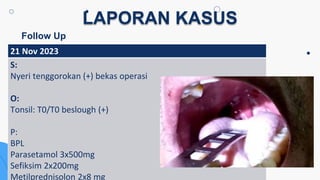 Diagnosis dan Tatalaksana Abses Peritonsilar | PPTX