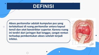 Diagnosis dan Tatalaksana Abses Peritonsilar | PPTX