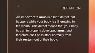 PPT Imperforated Anus.pptx