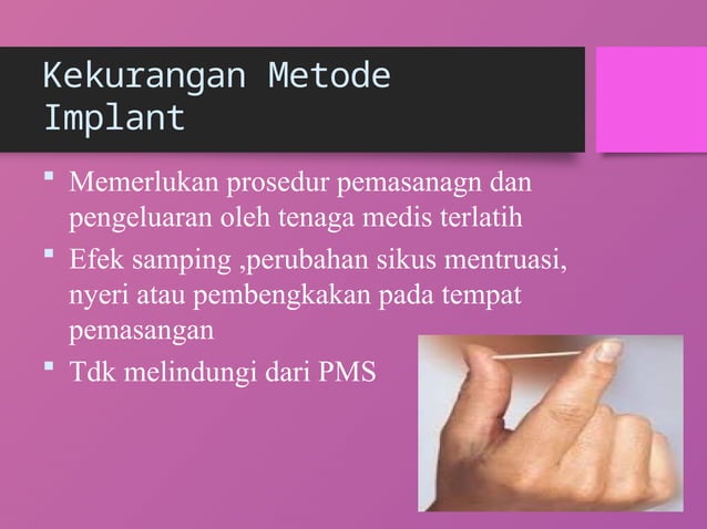 PPT METODE KONTRASEPSI JANGKA PANJANG IMPLANT | PPT