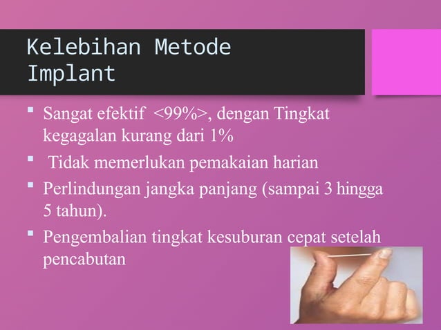 PPT METODE KONTRASEPSI JANGKA PANJANG IMPLANT | PPT