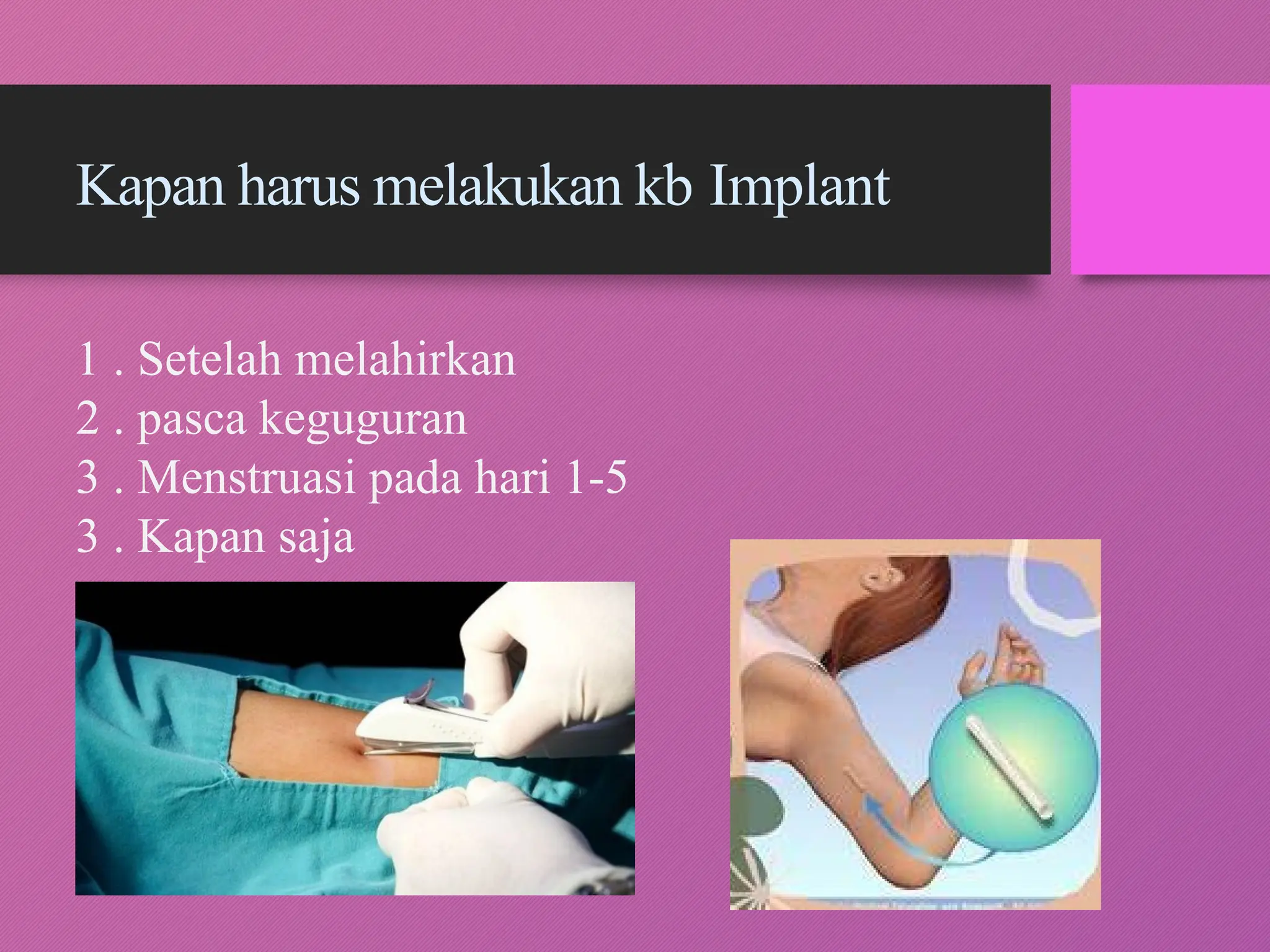 PPT METODE KONTRASEPSI JANGKA PANJANG IMPLAN.pptx