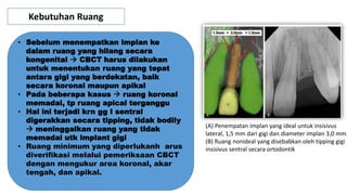 ppt implan chp 27. 20-31 educatin dentistry.pptx