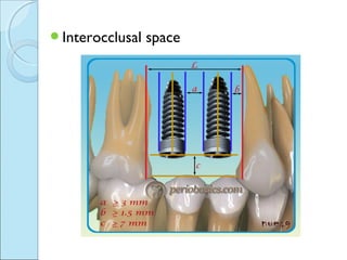 pretreatment Implant evaluation | PPT
