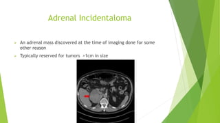 the adrenal incidentaloma | PPTX