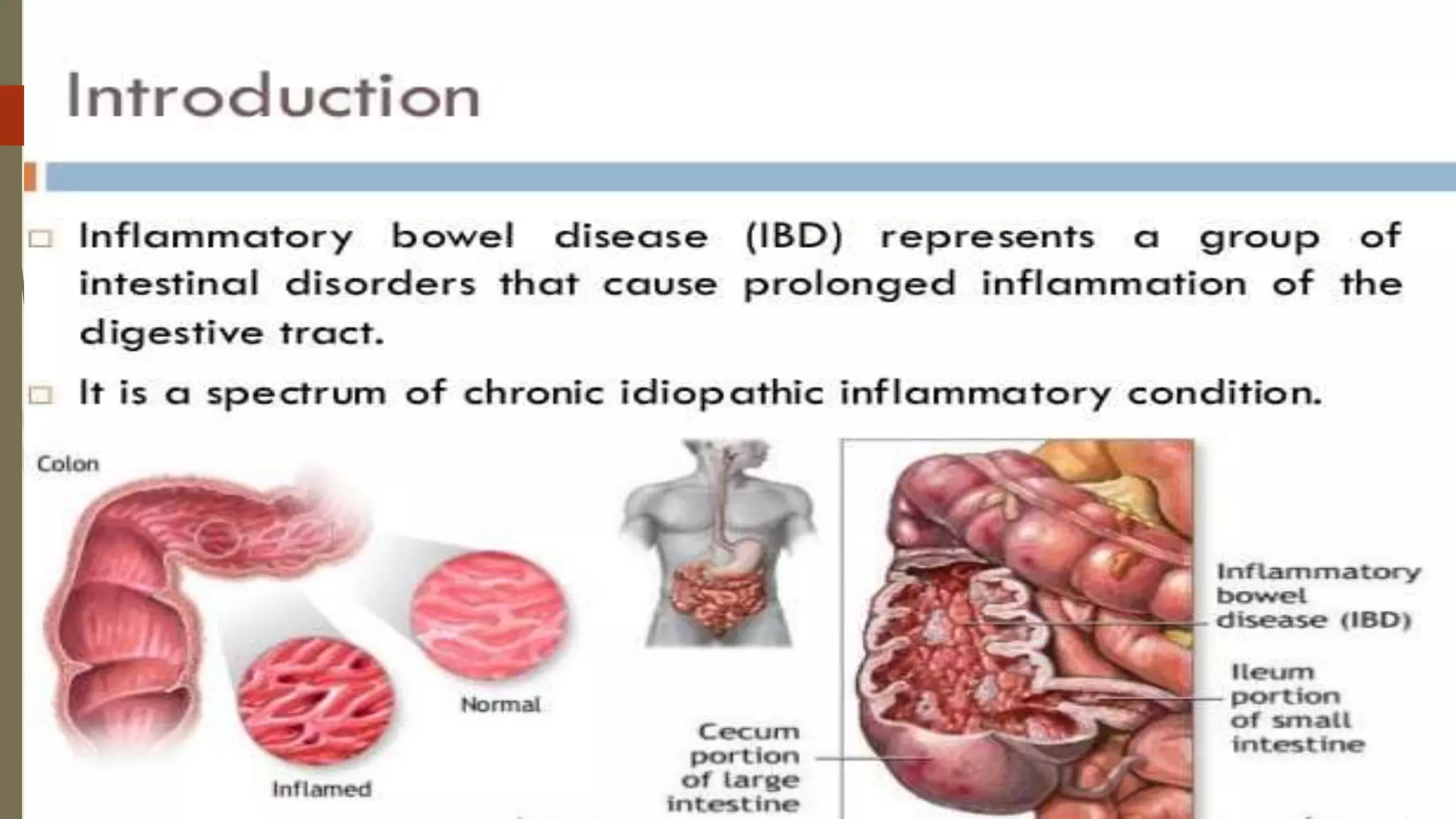 Inflammatory bowel Diseases pptx | PPT