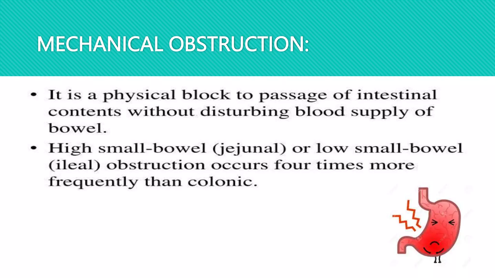 PPT_INSTESTINAL OBSTRUCTION_GI.pptx