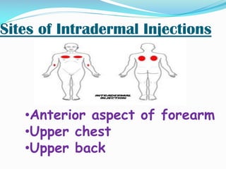 INTRADERMAL INJECTION | PDF | Skin and Dermatology | Diseases and Conditions