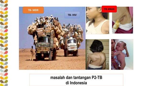 PPT INVESTIGASI KONTAK TB.ppt