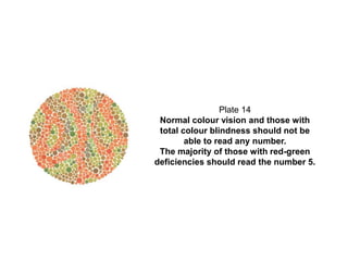 PPT Ishihara.pptx