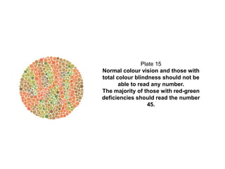 PPT Ishihara.pptx