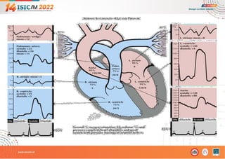 atrial septal defek kateterisasi jantung | PPT