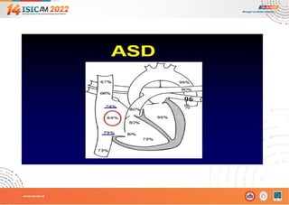 atrial septal defek kateterisasi jantung | PPT