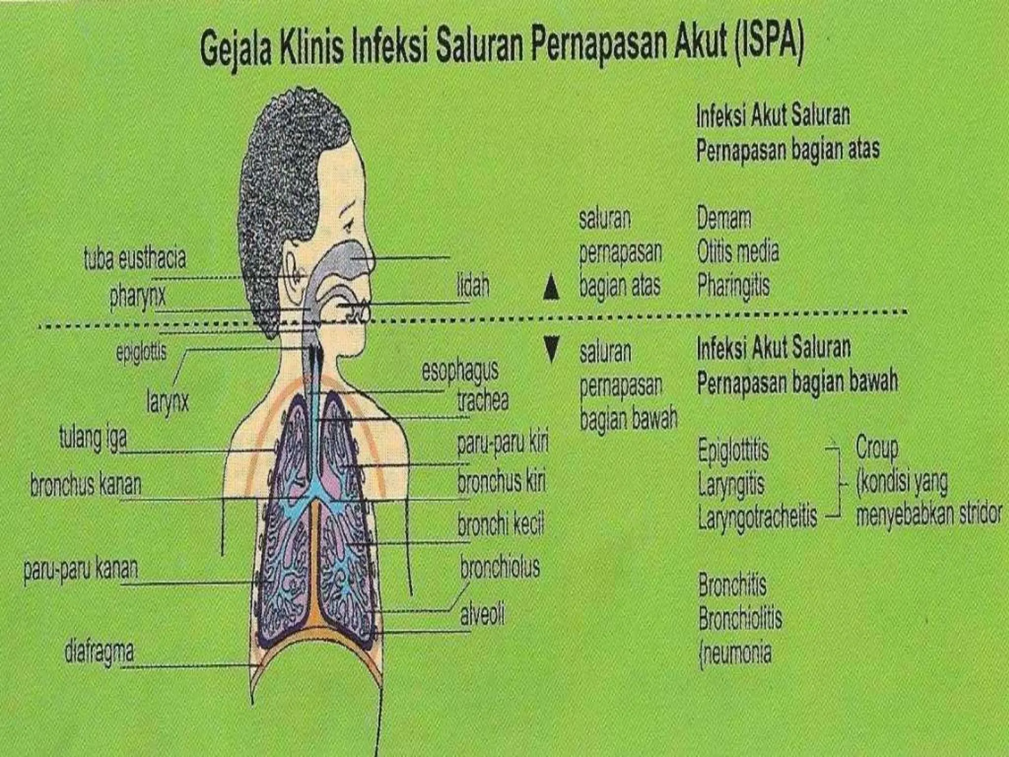 PPT PENYAKIT ISPA UNTUK KESEHATAN MANUSIA | PPTX