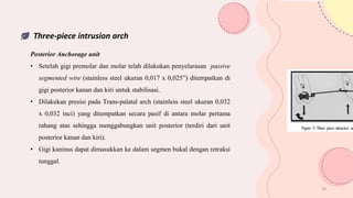 PPT JR Nurwahyuni.pdf