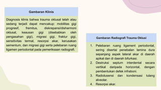 trauma oklusi: teganga yang berlebuh dari struktur pendukug gigi | PPTX