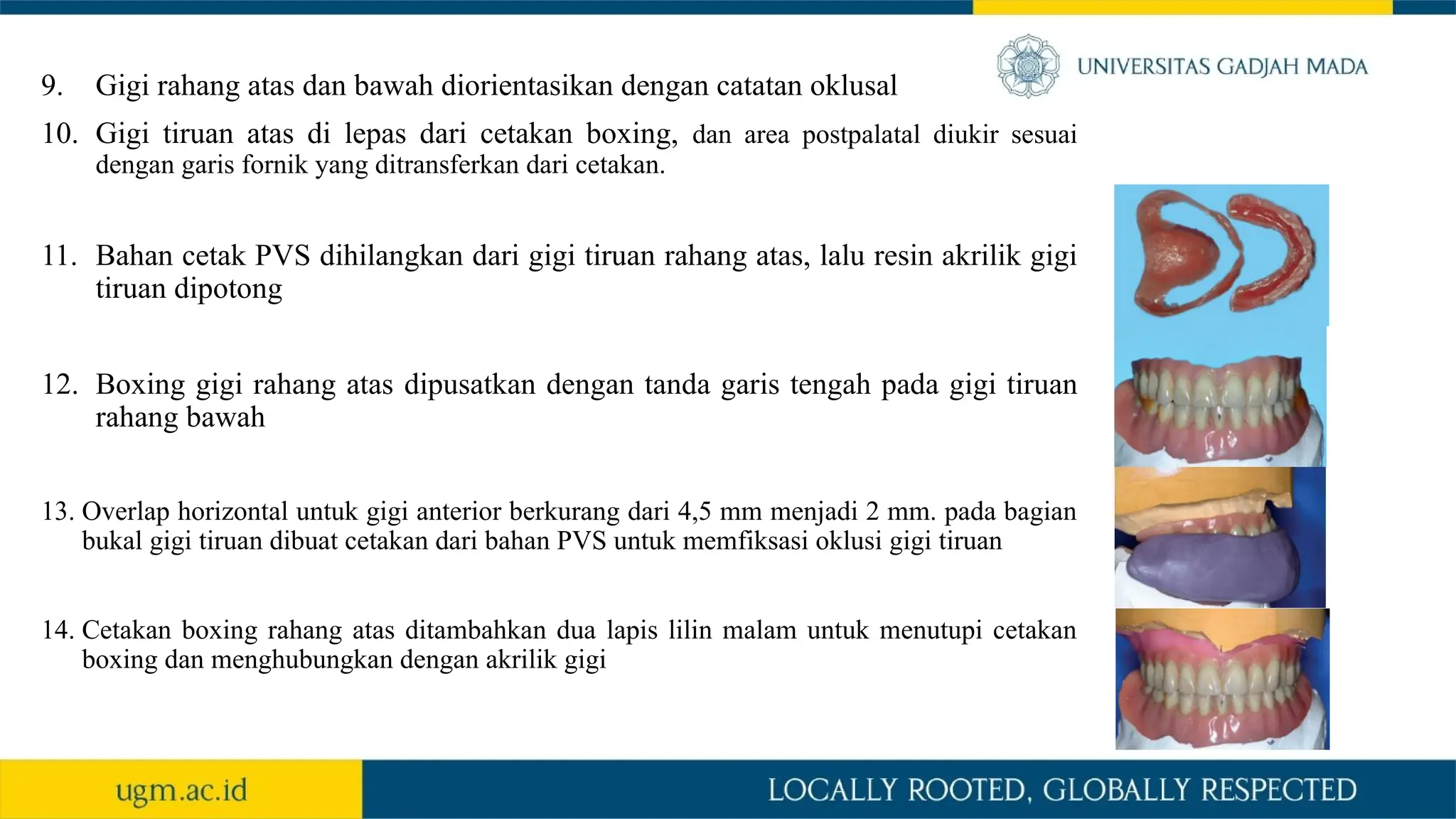 PPT Juring departement Prostodonsia.pptx