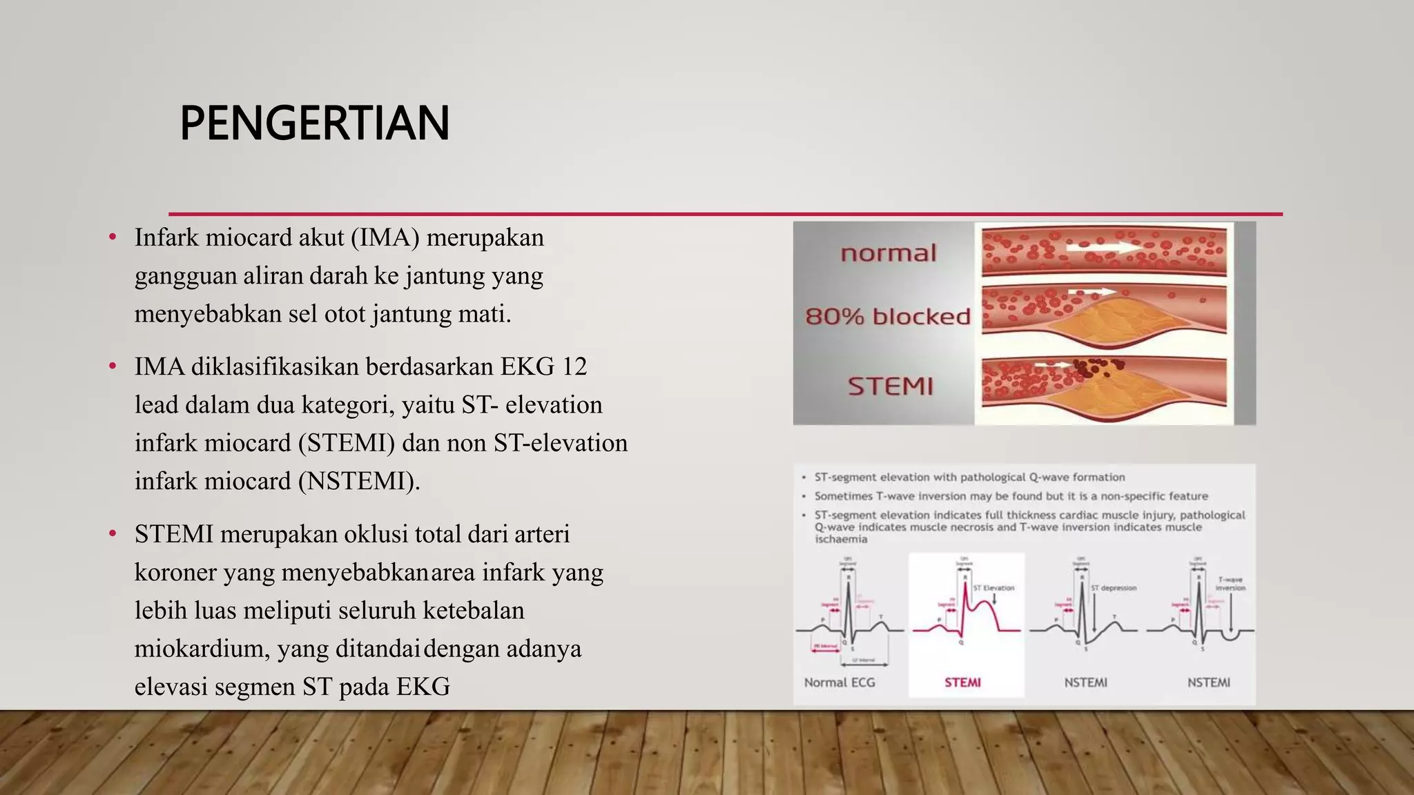ppt jurnal stemi.pptx