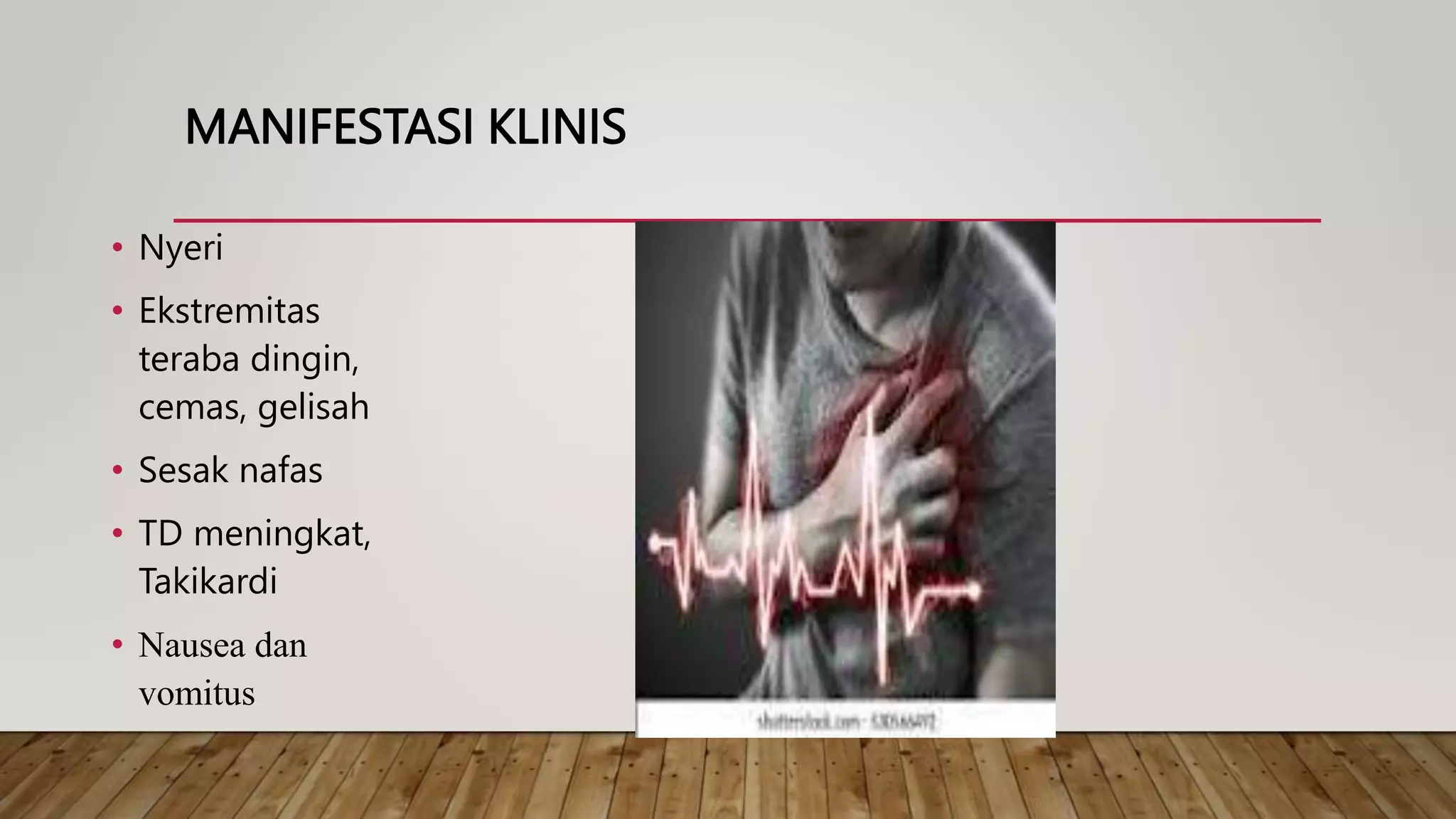 ppt jurnal stemi.pptx
