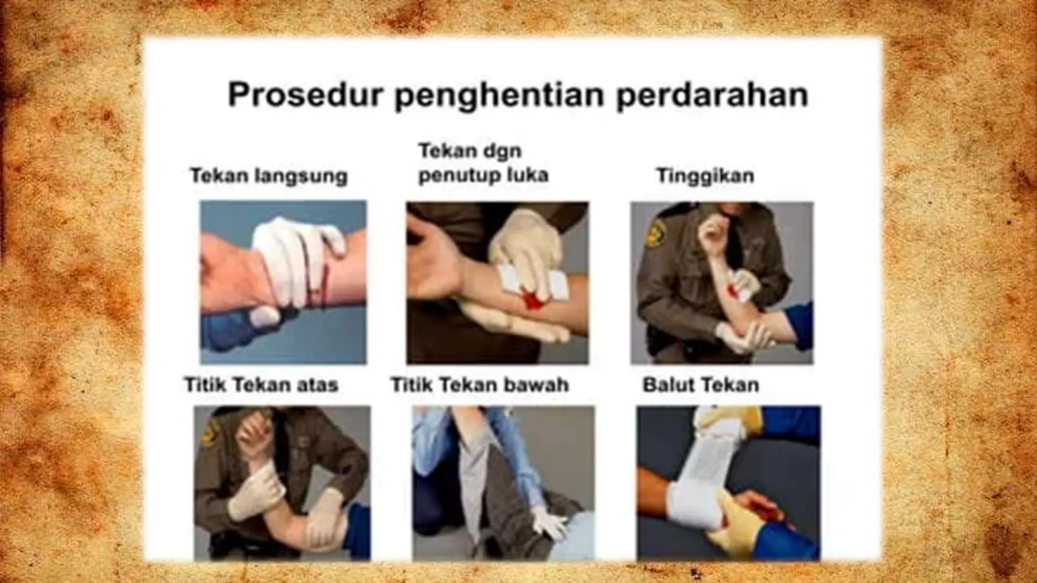 PPT PENGENDALIAN PADA LUKA TERBUKA DAN TERTUTUP.pptx