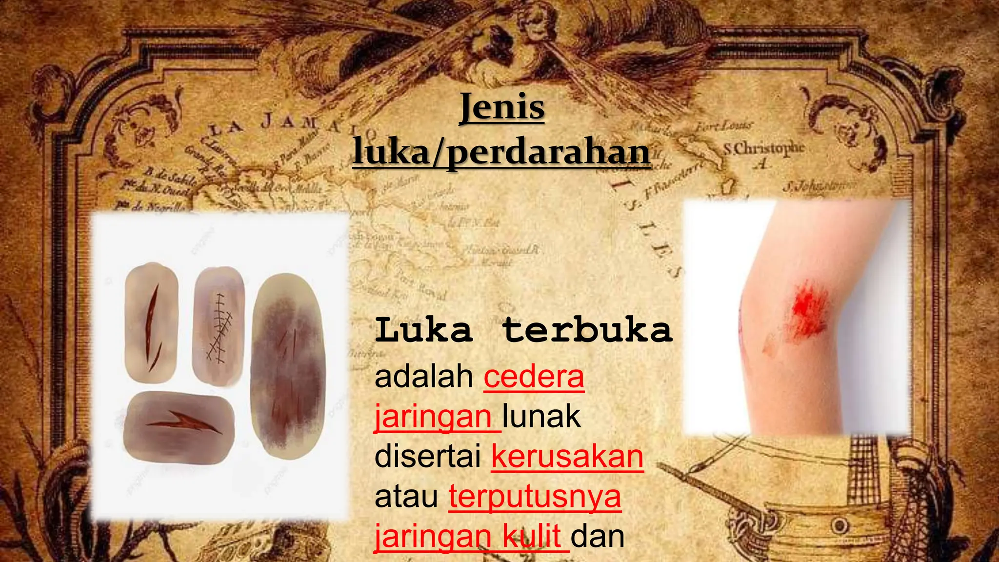 PPT PENGENDALIAN PADA LUKA TERBUKA DAN TERTUTUP.pptx