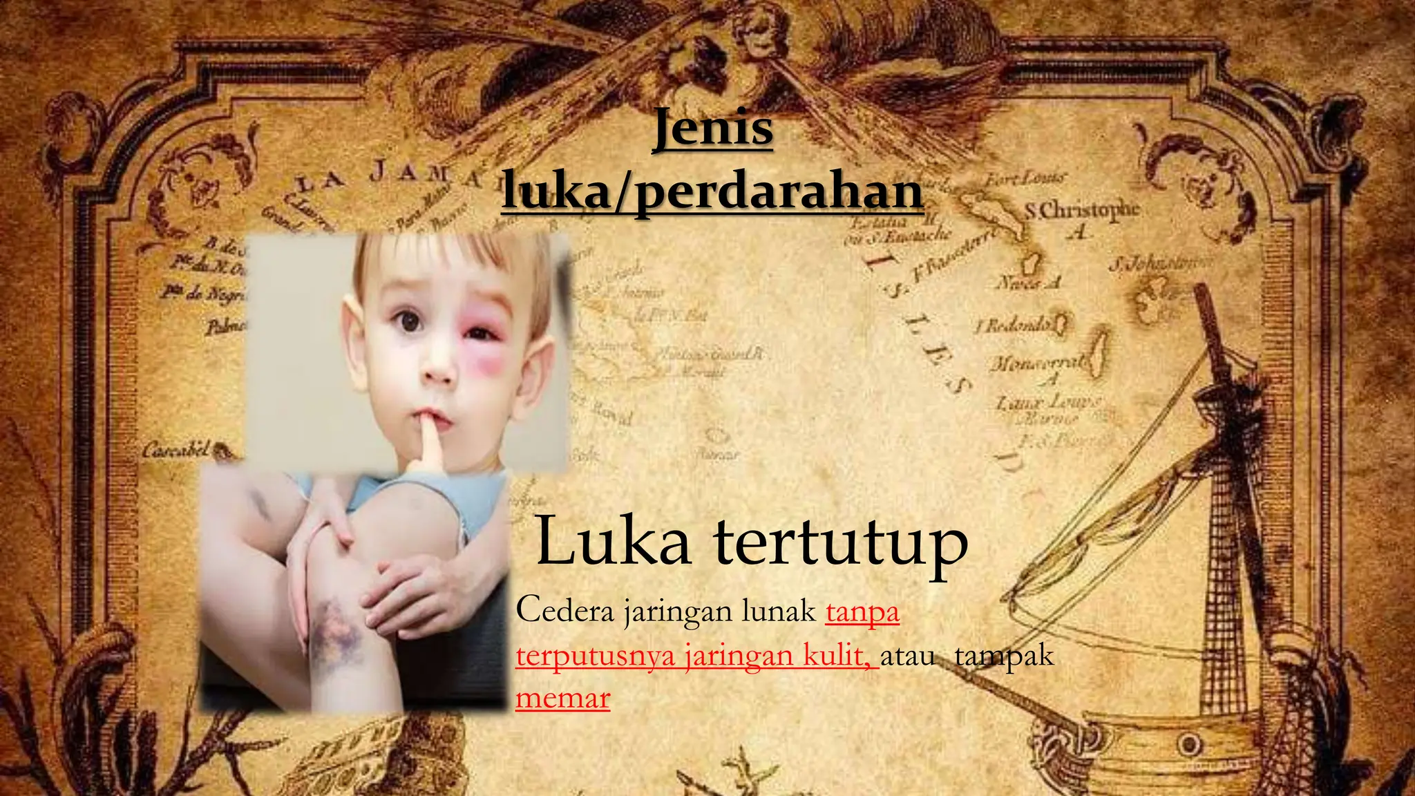 PPT PENGENDALIAN PADA LUKA TERBUKA DAN TERTUTUP.pptx