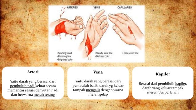 PPT PENGENDALIAN PADA LUKA TERBUKA DAN TERTUTUP.pptx