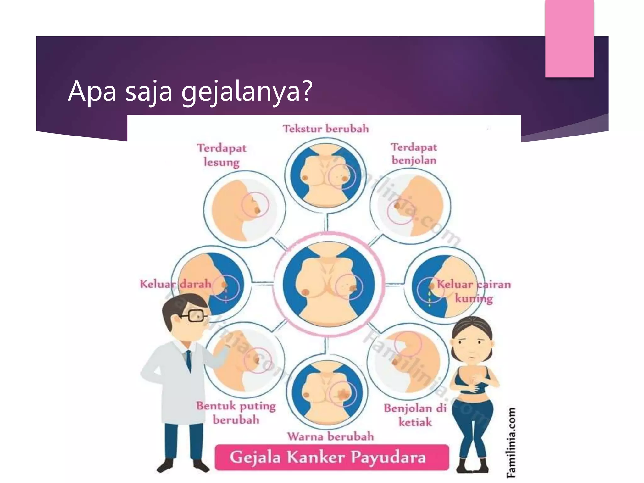 PPT KANKER PAYUDARA.pptx