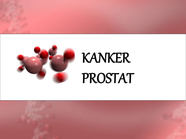 Ppt kanker prostat | PPTX