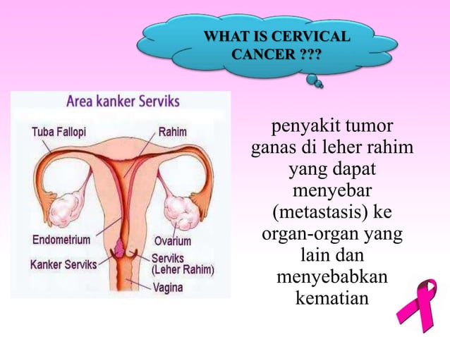 PPT kanker serviks | PPTX