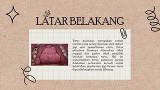 PPT KASUS 1 TORUS PALATINUS PENGERTIAN, JENIS.pptx