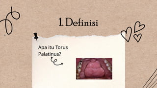 PPT KASUS 1 TORUS PALATINUS PENGERTIAN, JENIS.pptx