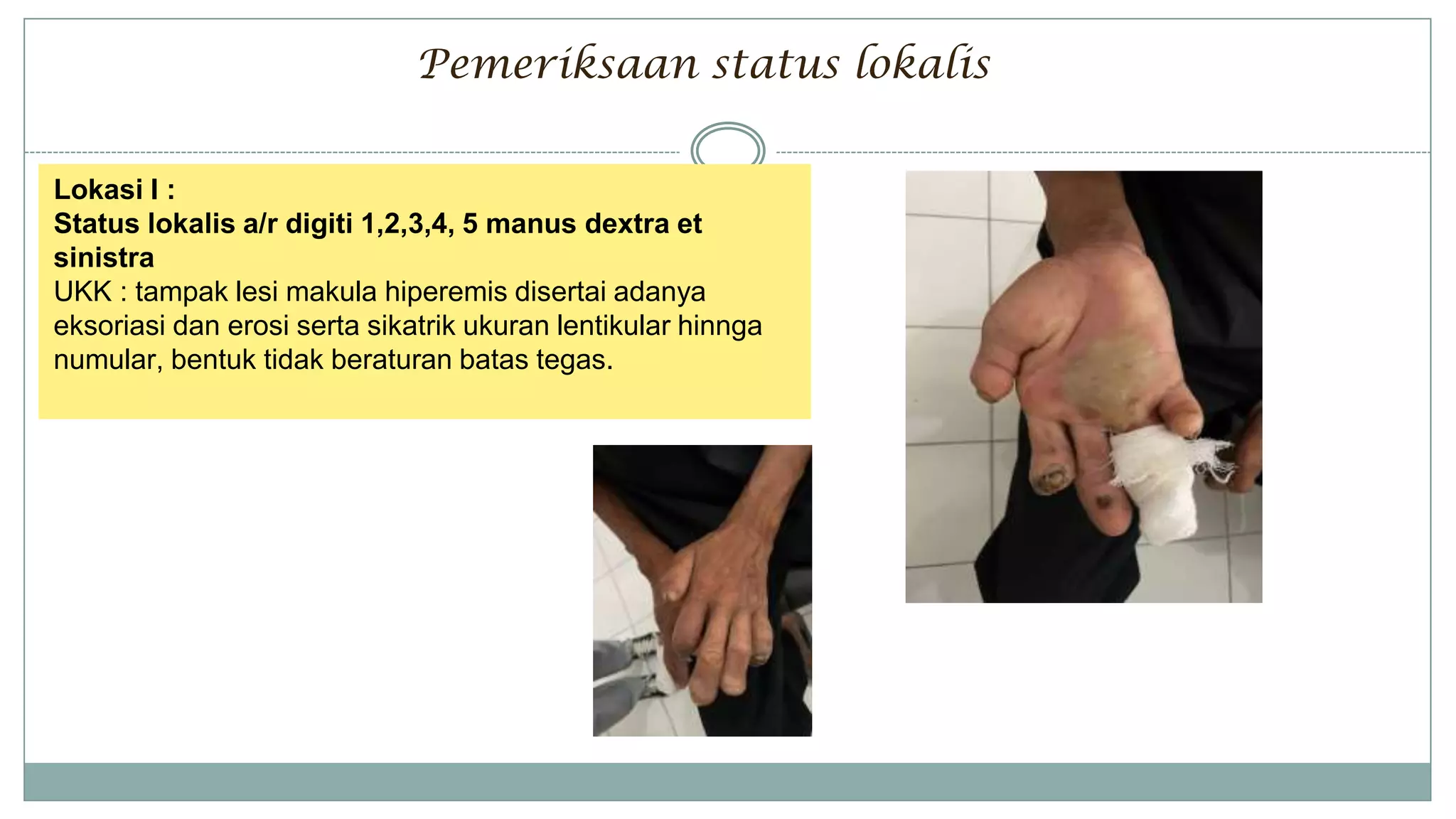 PPT KASUS KRONIK IKHWAN HAPIS.pptx